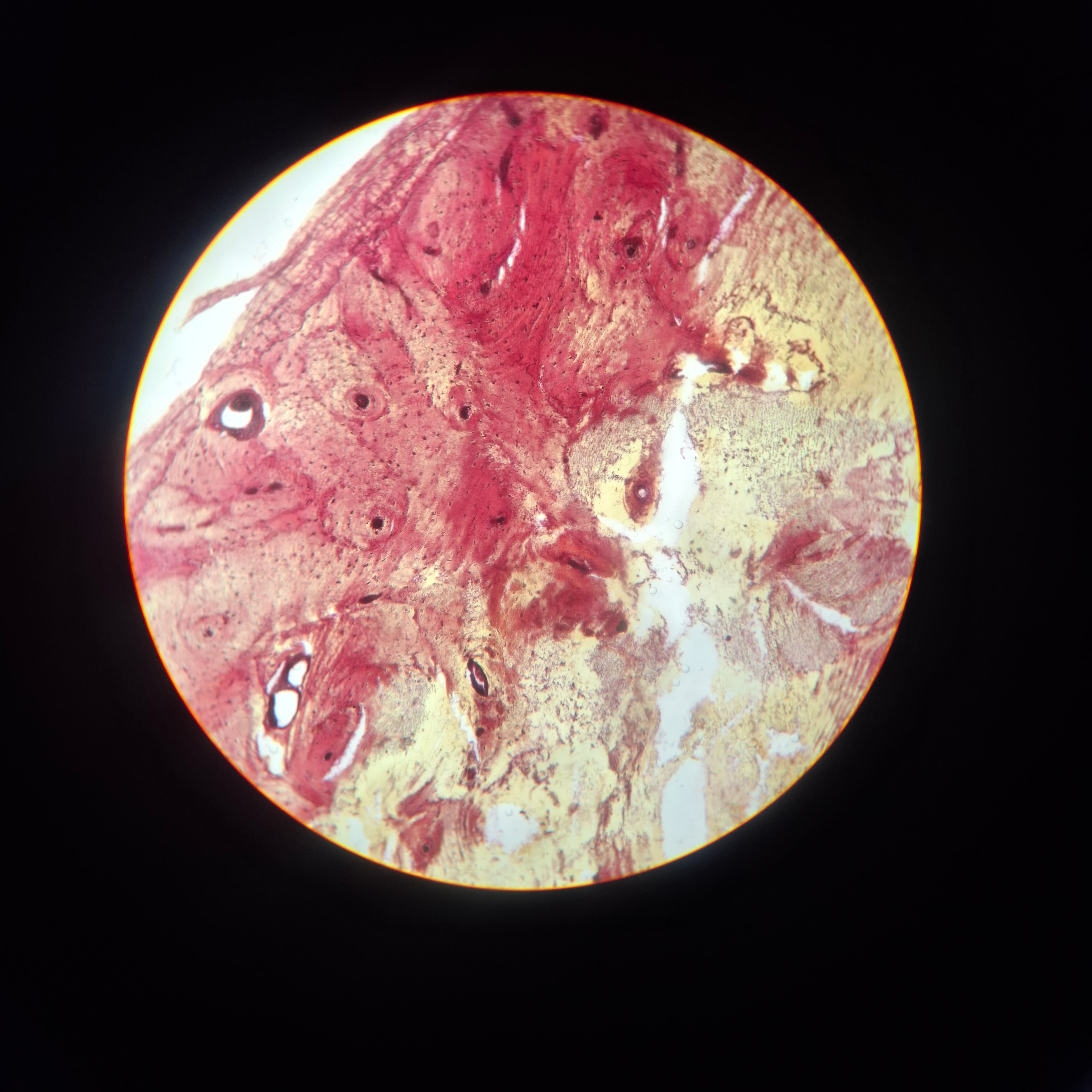 Bone Histology Atlas | Microscopic Images | Histovoid