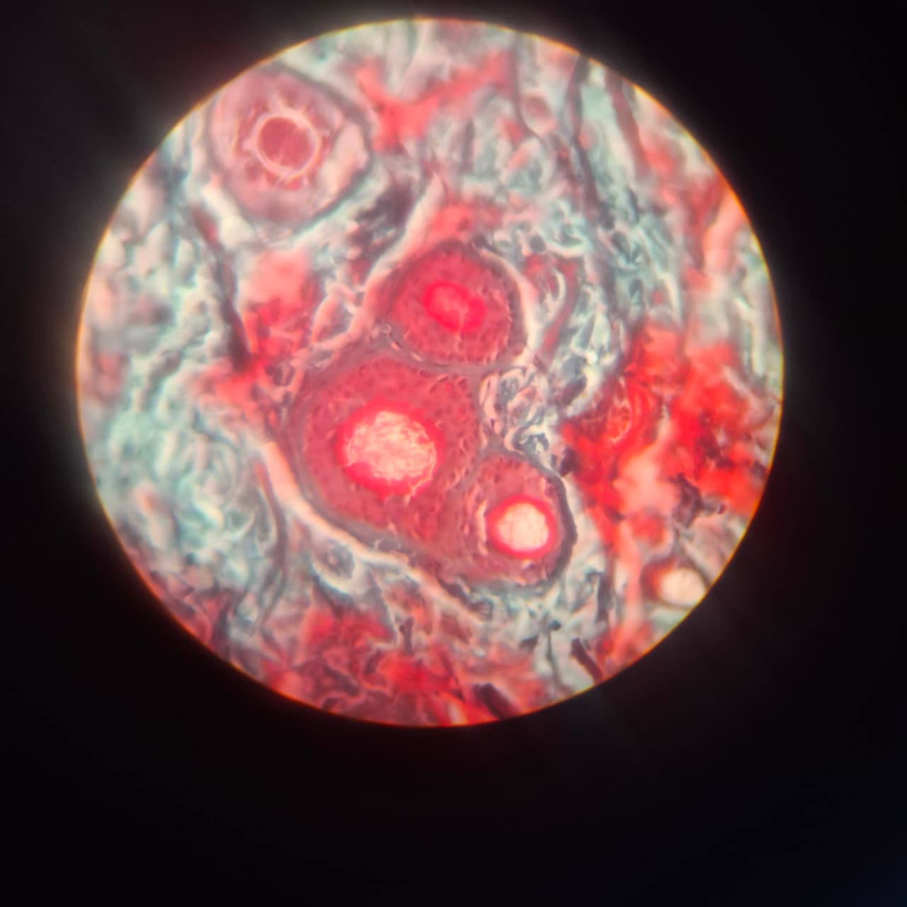 Skin Histology Atlas | Microscopic Images | Histovoid