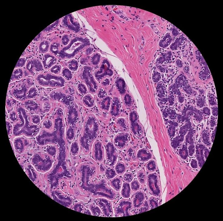 Skin Histology Atlas | Microscopic Images | Histovoid