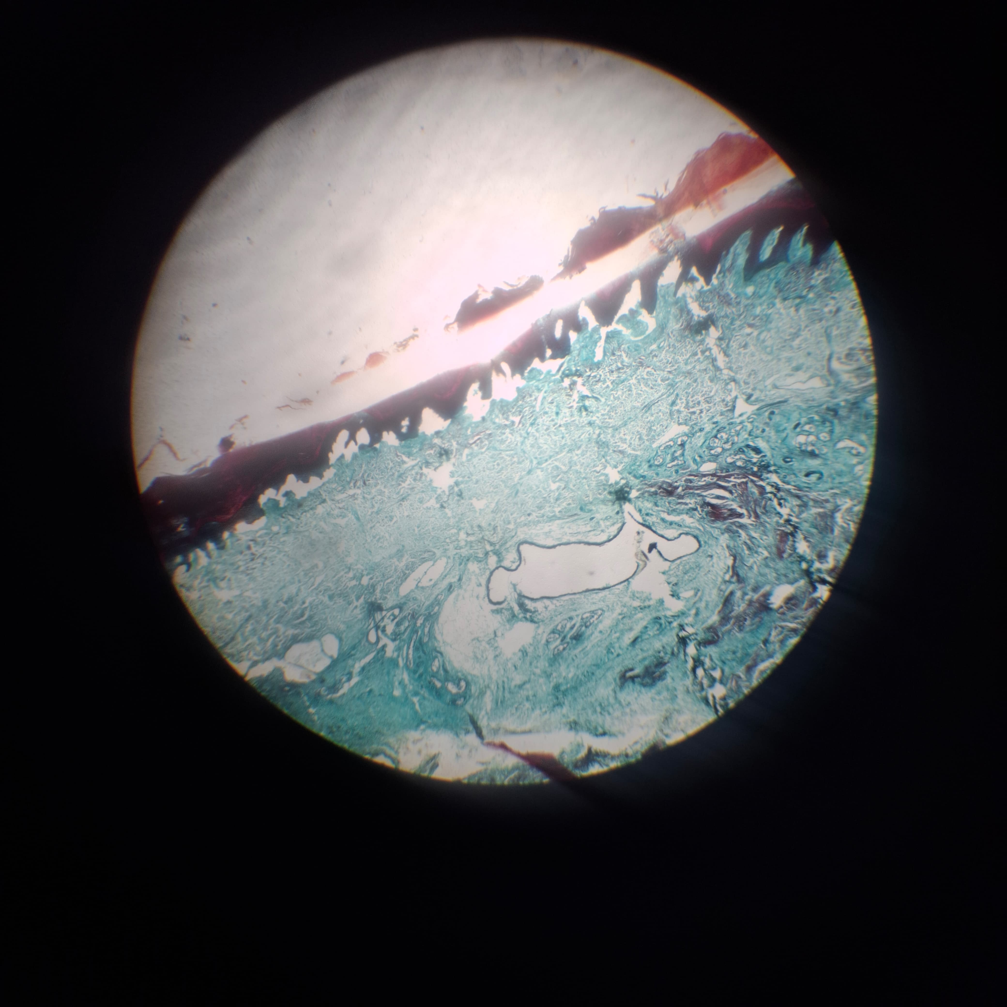 Skin Histology Atlas | Microscopic Images | Histovoid